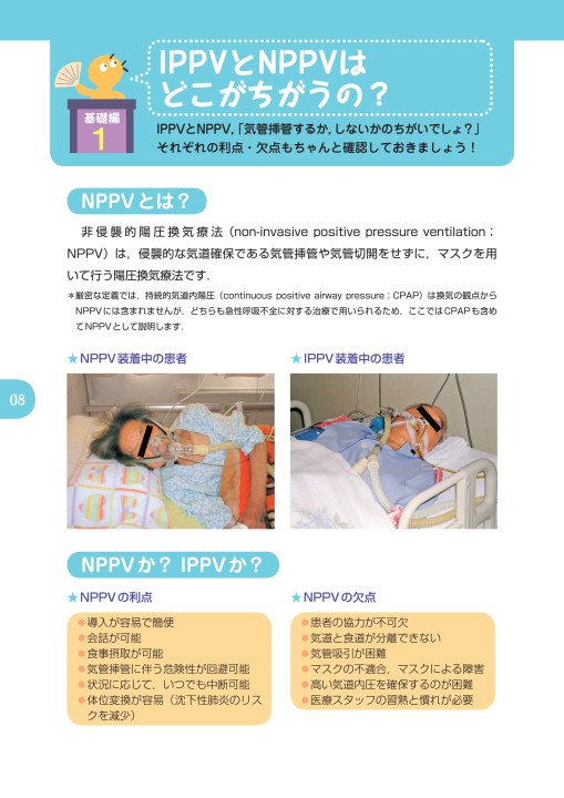 Nppv Cpap 違い